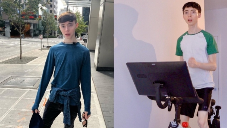 Ο 35χρονος που μοιάζει με έφηβο αποκάλυψε τα μυστικά του κατά της ...